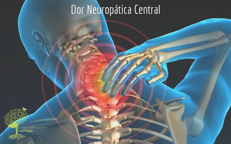 Dor Neuropática Central | Dr Willian Rezende - Neurologia Hoje ...
