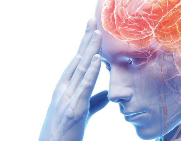 O que é e como tratar o AVC? - Clínica Regenerati | Neurologia ...